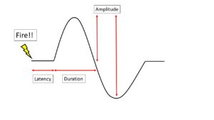 EMG Basics part 2 : Interpretation of Nerve Conduction Test Results ...