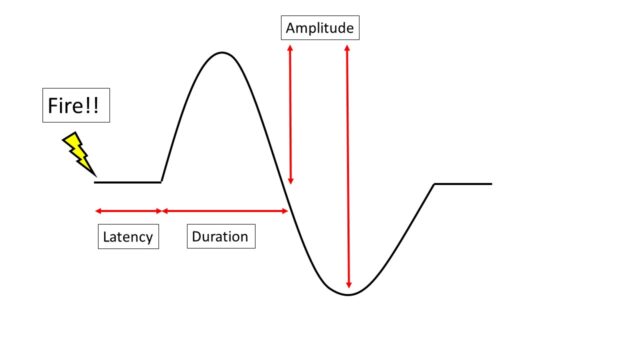 EMG Basics part 2 : Interpretation of Nerve Conduction Test Results ...
